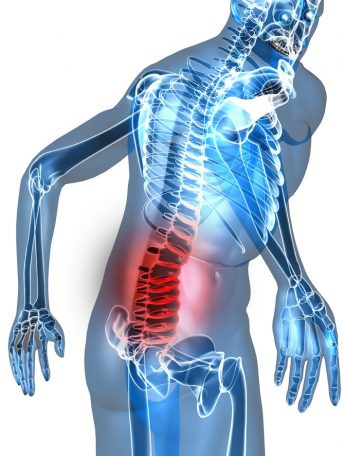 Back Pain – poster image – cropped | Complement Healthcare